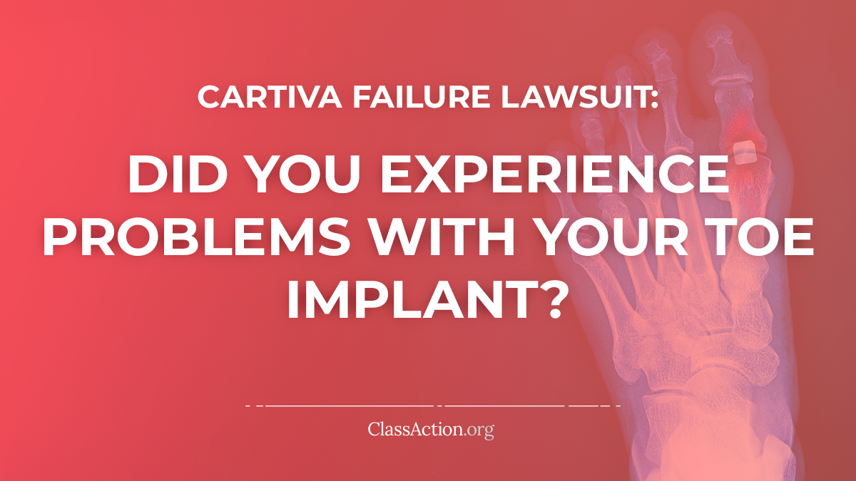 Cartiva Failure Lawsuit | Toe Implant Problems